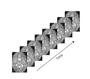 【fMRI Note】Module 1 Introductions and Ground Rule - 知乎