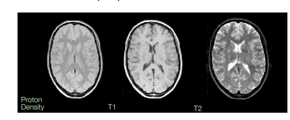 【fMRI Note】Module 1 Introductions and Ground Rule - 知乎