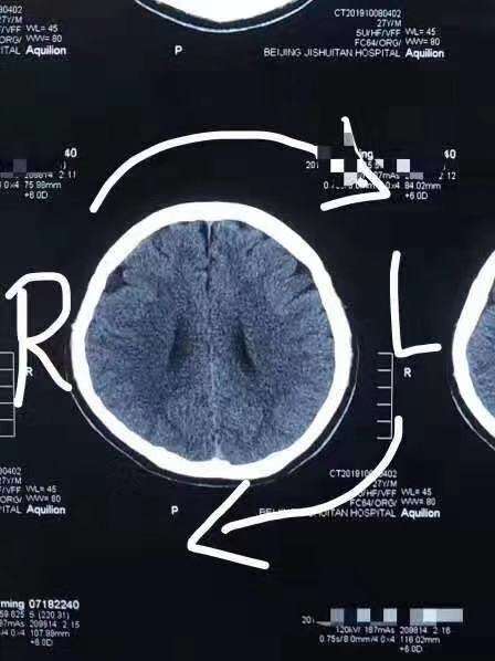 康复于老师 的想法: Yakovlevian 扭转存在于我们的大脑之中，… - 知乎