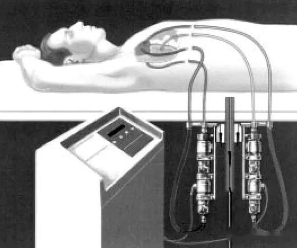 重磅！强生斥资166亿美元收购Abiomed - 知乎