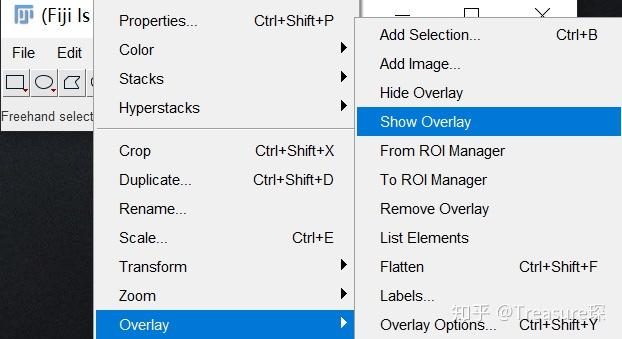 ImageJ实用技巧——图像标注(基本功能篇) - 知乎