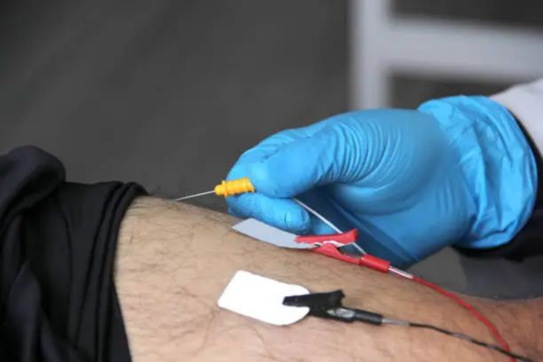 EMG肌电信号测量与常用分析方法 - 知乎