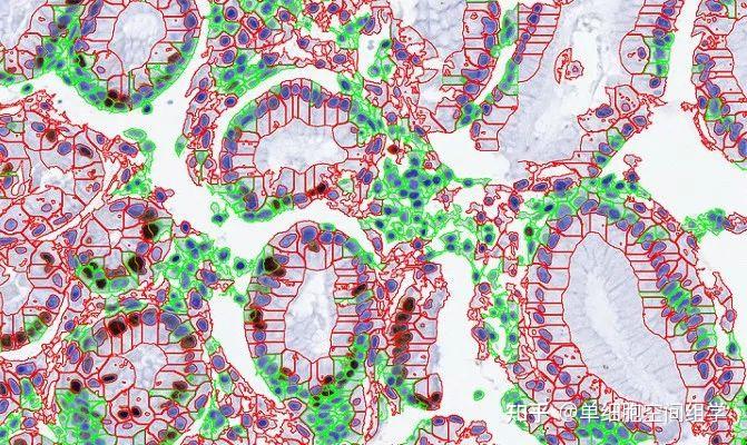 如何获得精准客观的组织学定量分析数据？——TissueFAXS Cytometry技术 - 知乎