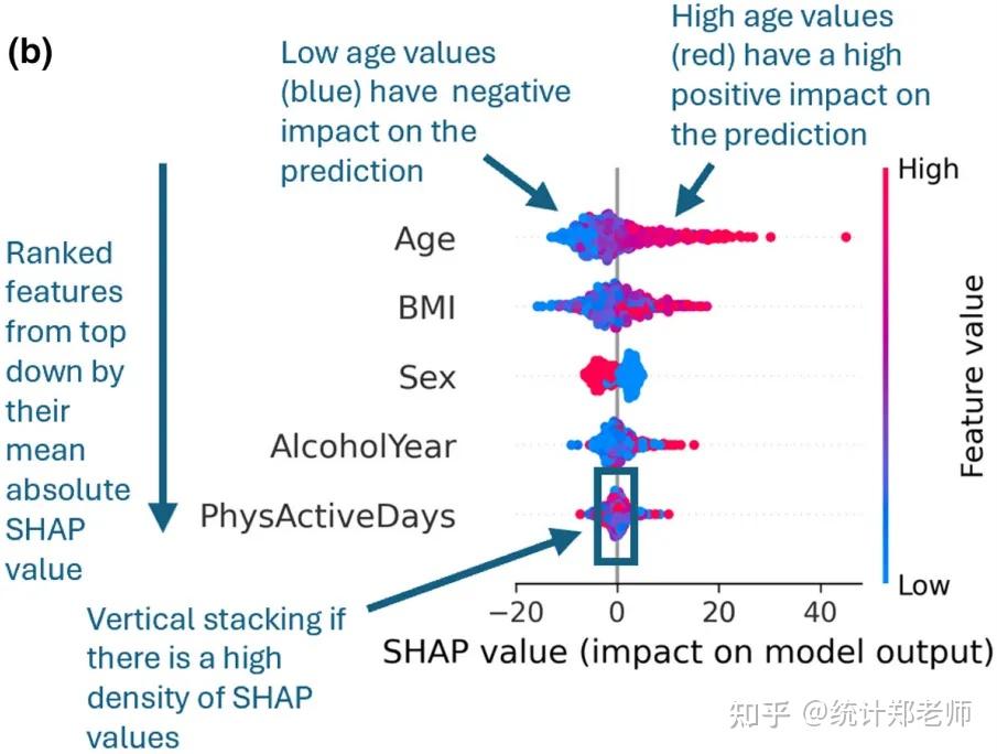 SHAP可视化方法，临床预测模型解释新框架！ - 知乎