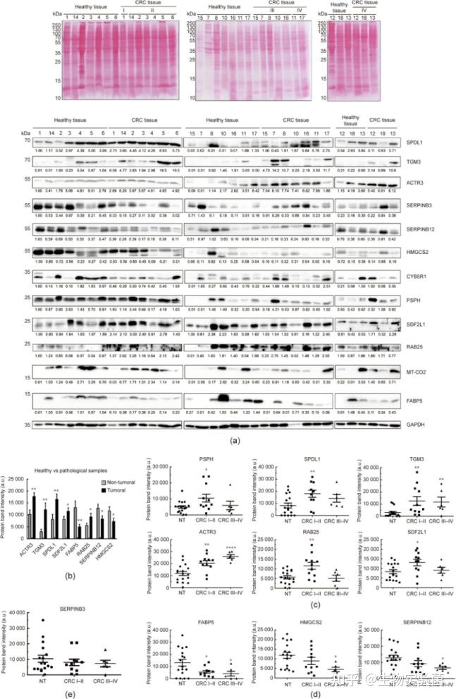 Western Blot 原理及基础应用 - 知乎