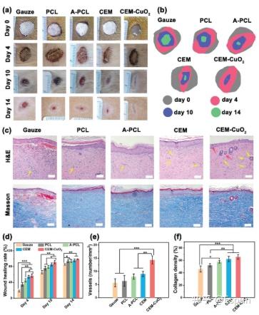 四川大学张利&李玉宝教授团队Small：负载CuO2的纳米复合纤维膜用于糖尿病伤口治疗 - 知乎