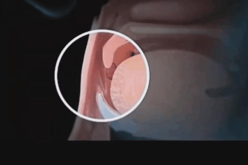 睡眠不好鼾声不断 拯救我的呼吸道 体验LEPU乐普R20呼吸机来解忧 - 知乎