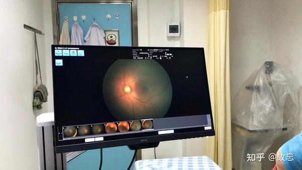 全球领先新生儿眼底检查设备 RetCam - 知乎