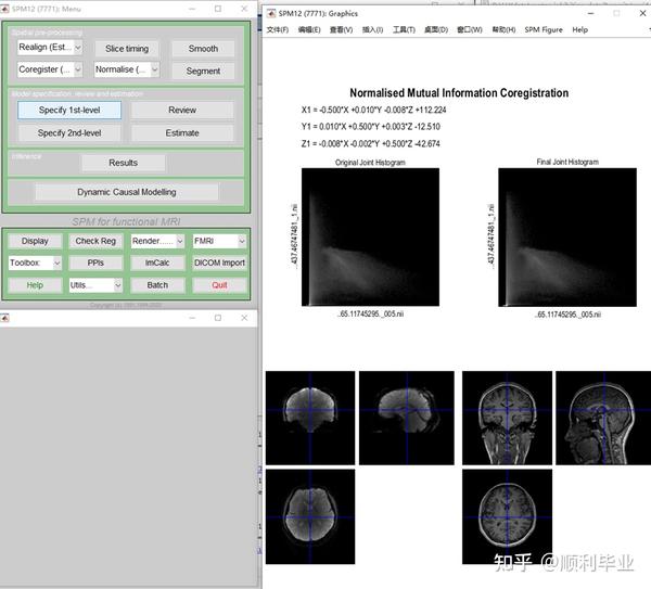 MRI数据预处理 - 知乎