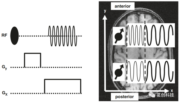 功能性磁共振成像的基础知识（总结篇） - 知乎