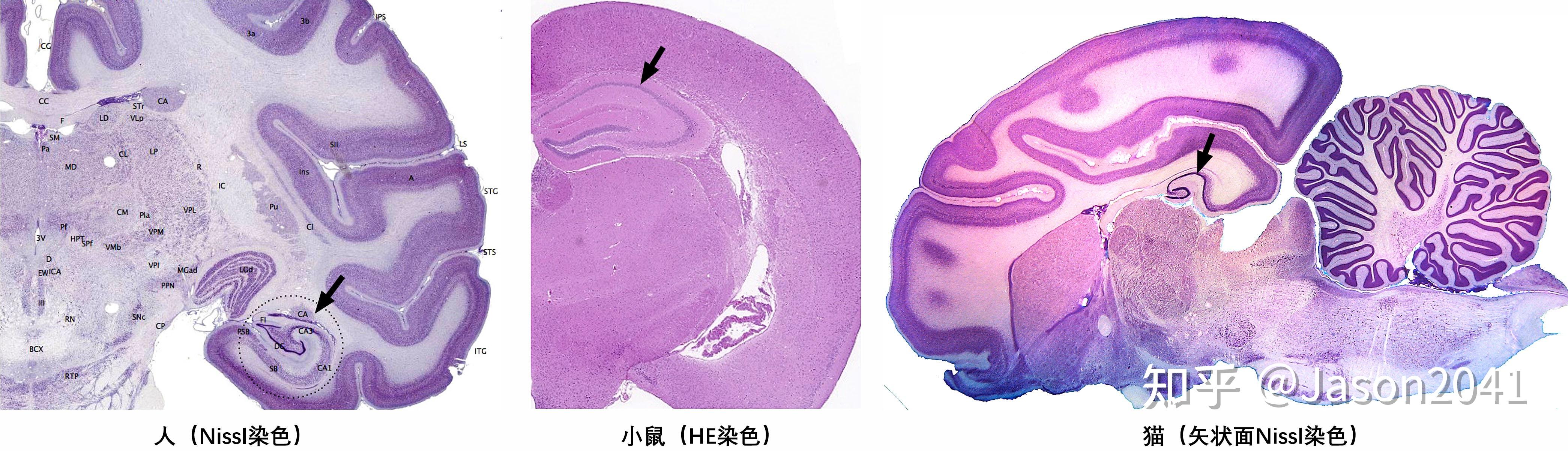 脑海马结构简介 - 知乎