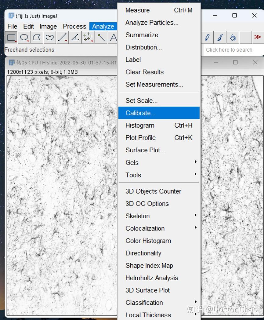 Image J 统计免疫组化片子阳性信号的平均光密度值教程 - 知乎