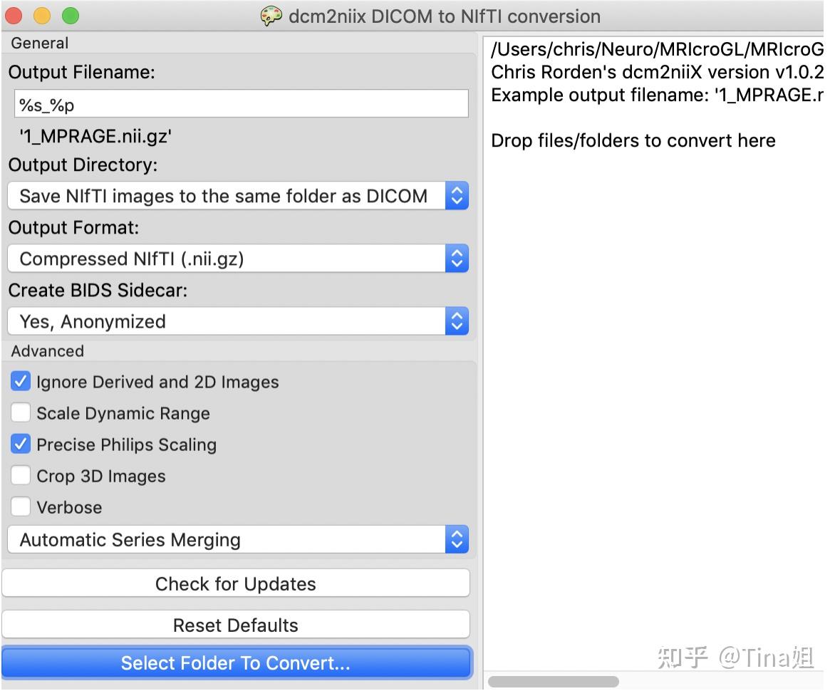 【最全】如何不写代码将 Dicom 图像转 Nifti 格式， 7种工具任你选！ - 知乎