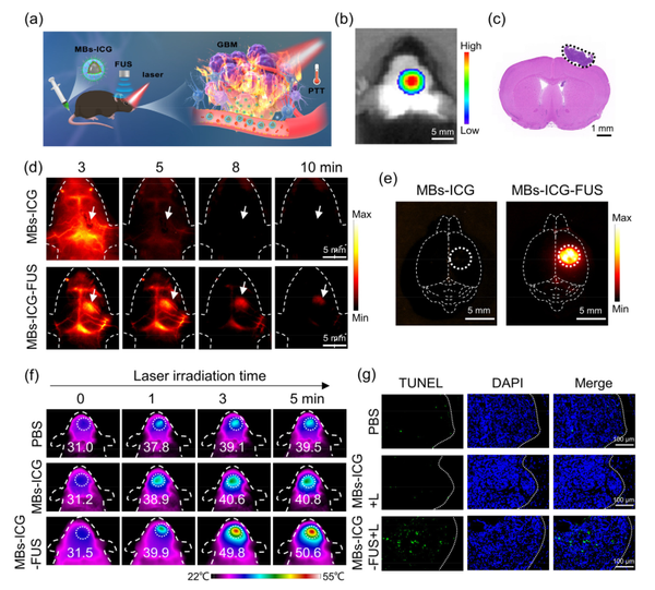 纳米材料 | 超声诱导以打开血脑屏障的 NIR-II 荧光可视化，用于使用ICG吲哚菁绿微泡增强光热治疗胶质母细胞瘤 - 知乎