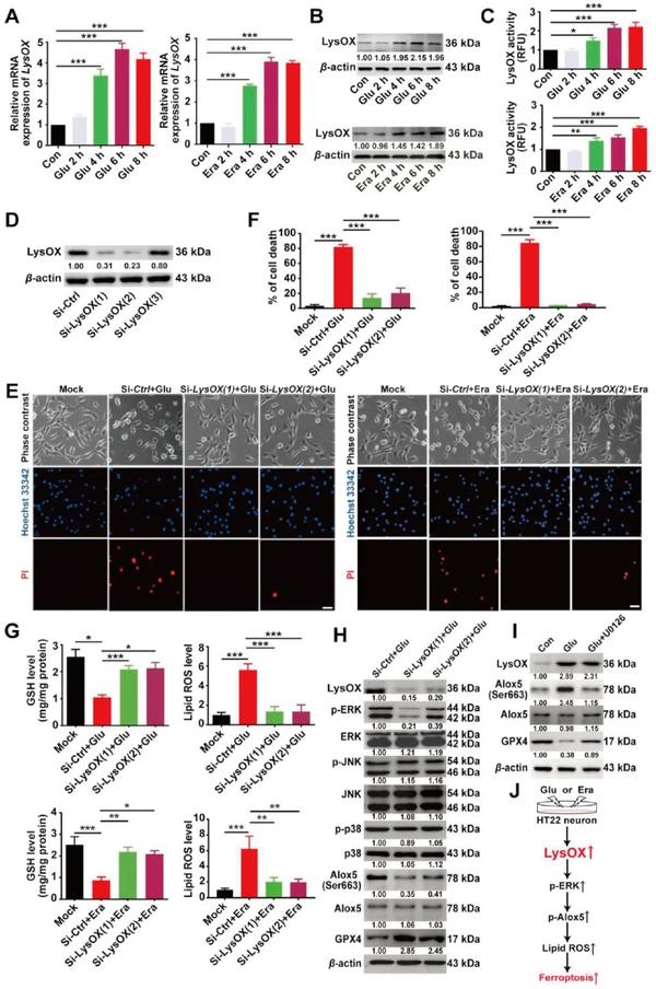APSB | 湘雅毛小元/刘昭前·兰大金卫林教授等合作揭示铁死亡与癫痫脑损伤之间的分子机制 - 知乎