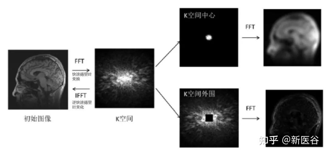 影像时间|MRI的“存储器”——K Space - 知乎