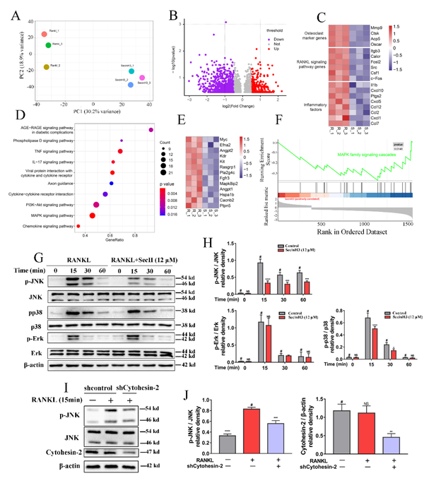 Pharmacol Res︱李锋/关邯峰课题组揭示Cytohesin-2/ARF1调控破骨细胞分化和影响骨质疏松发生发展的机制 - 知乎
