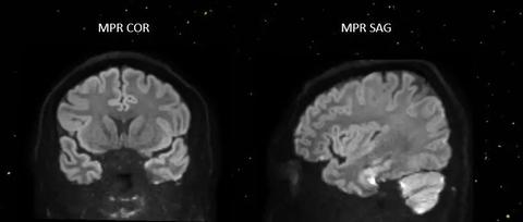 消除EPI几何形变技术——EPIC - 知乎