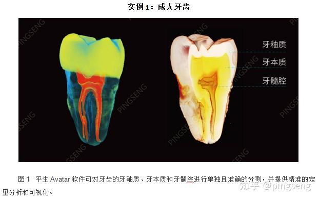 Micro CT在齿科研究中的应用 - 知乎