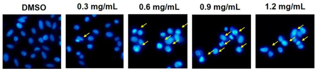 细胞凋亡——如何检测？| MedChemExpress - 知乎