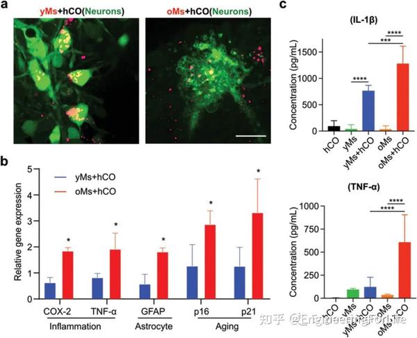 《Advanced Science》：哈佛大学Luke P.Lee类器官研究再下一城，成功监测免疫驱动大脑衰老过程 - 知乎