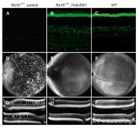 革新与突破——AAV腺相关病毒突变体揭秘 - 知乎