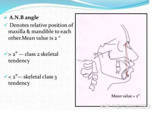 重庆牙齿矫正(正畸）|你的嘴凸是牙性还是骨性?怎么通过SNA、SNB、ANB角判断面型？ - 知乎