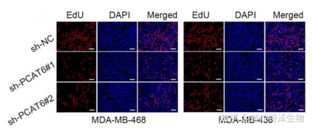 手把手教学｜细胞增殖检测法：EdU染色 - 知乎
