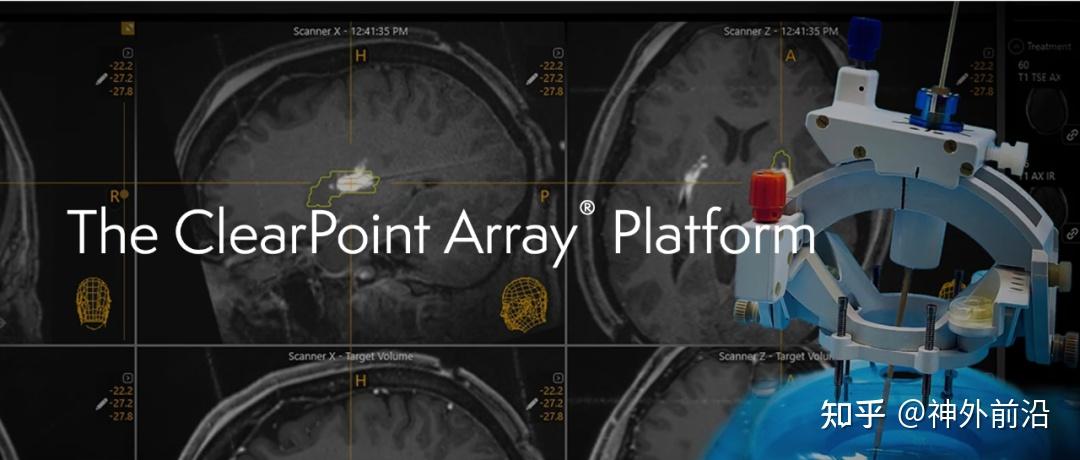 技术动态 | FDA批准SmartFrame OR神经外科立体定向系统 - 知乎