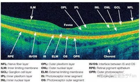 眼科利器OCT的原理浅析 - 知乎