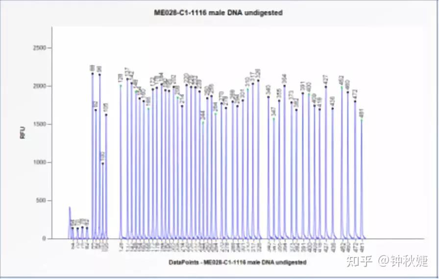 Prader-Willi(PWS)综合征的基因检测 - 知乎