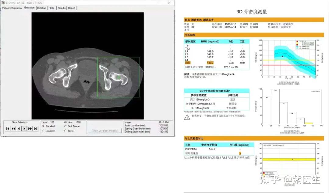 定量CT（QCT）是什么？临床应用有哪些？ - 知乎