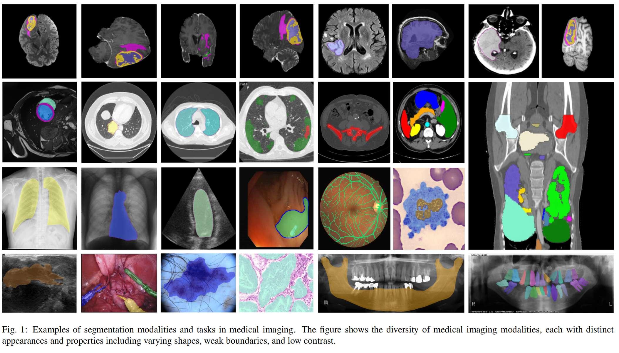 Medical Image Analysis：医学图像分割最新进展综述 - 知乎