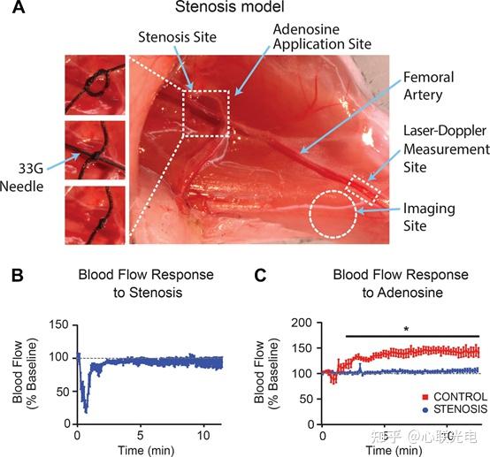 Am J Physiol Heart Circ Physiol ：周细胞收缩是动脉狭窄充血过程中毛细血管收缩的基础 - 知乎