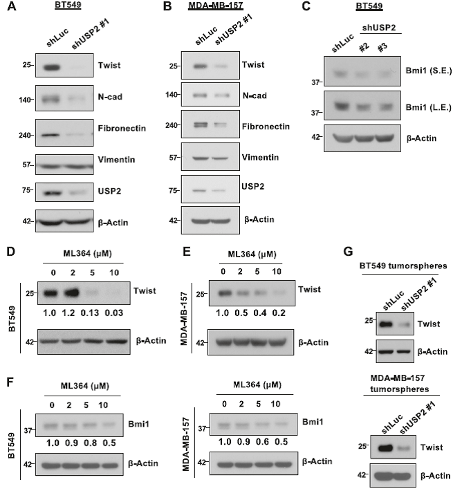 抑制USP2可消除癌症干细胞并增强TNBC对化疗的反应 - 知乎