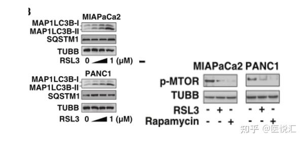 i Hope学院｜杨静医生：MTOR和GPX4信号的相互作用调节自噬依赖性癌细胞铁死亡 - 知乎