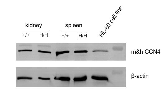 CCN蛋白家族--各有特色的促癌三兄弟 - 知乎