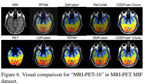 CVPR2023：结合CNN和Transformer的多任务多模态图像融合方法 - 知乎