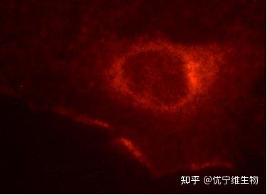 小G蛋白Rac1——肌动蛋白细胞骨架动力学和GLUT4的调节因子 - 知乎