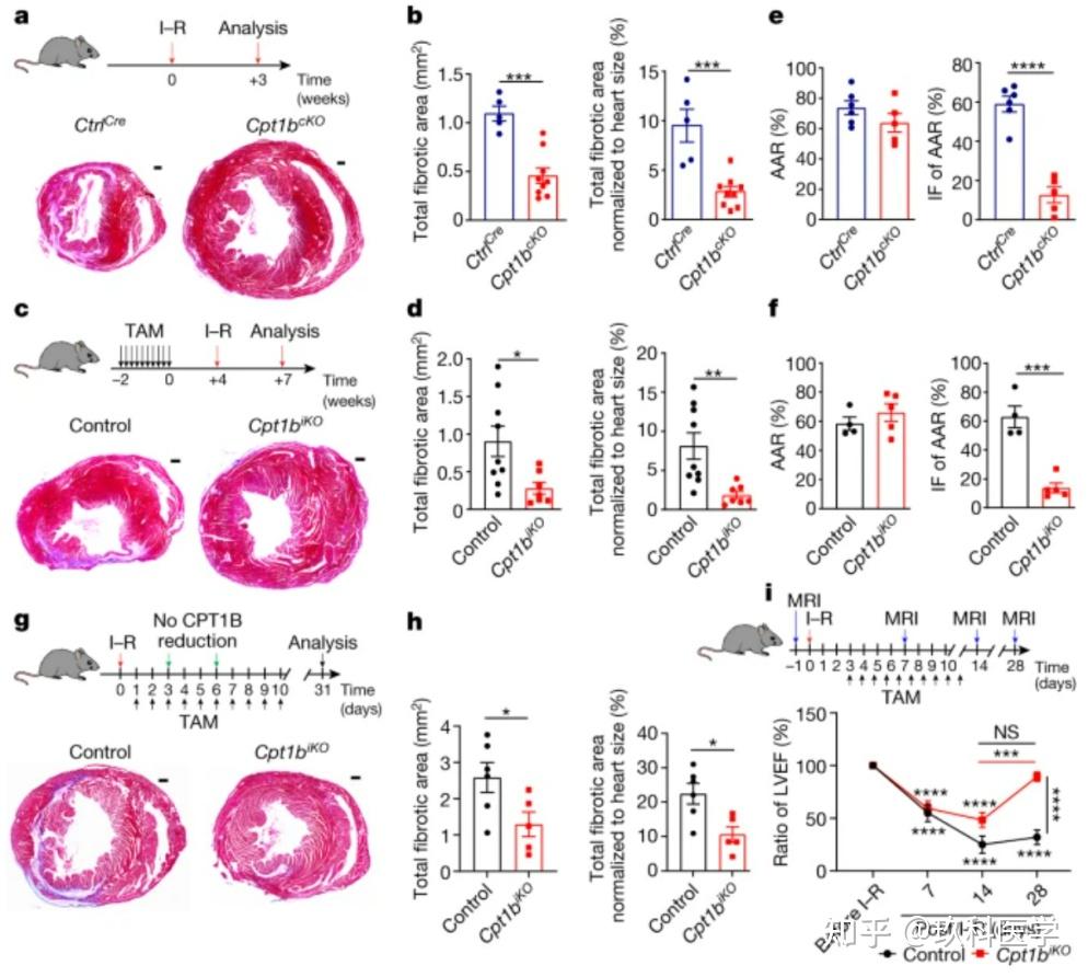 Nature重磅！抑制脂肪酸氧化能让心脏再生？ - 知乎