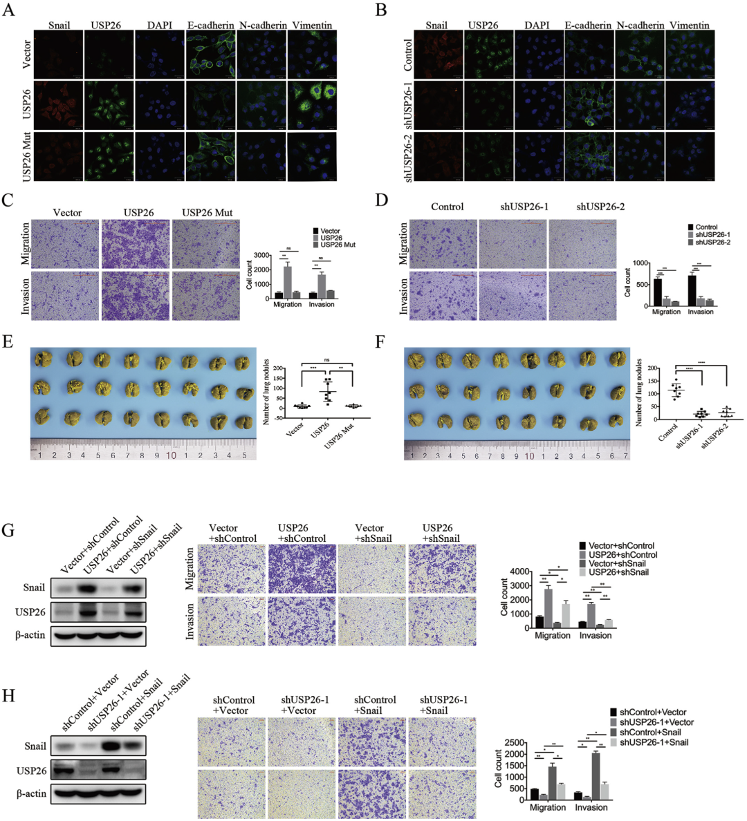 USP26通过稳定Snail促进食管鳞状细胞癌转移 - 知乎