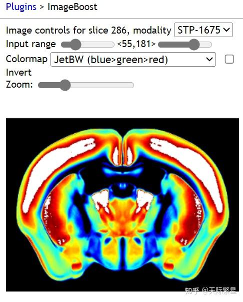 Scalable Brain Atlas使用 - 知乎