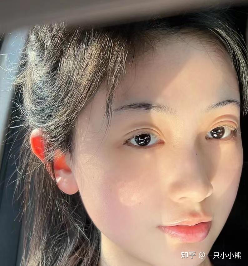 简单说一下我这个黄黑皮怎么变白的!(25岁女生真实祛黄变白全过程) 知乎