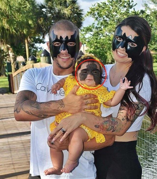 曾轰动一时的“蝙蝠侠宝宝”，经历7次手术后，如今长什么样？ - 知乎