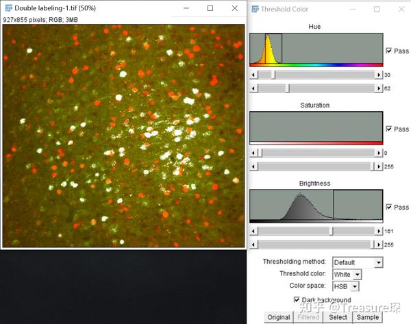 ImageJ实用技巧——荧光共标细胞计数(解放双手篇) - 知乎
