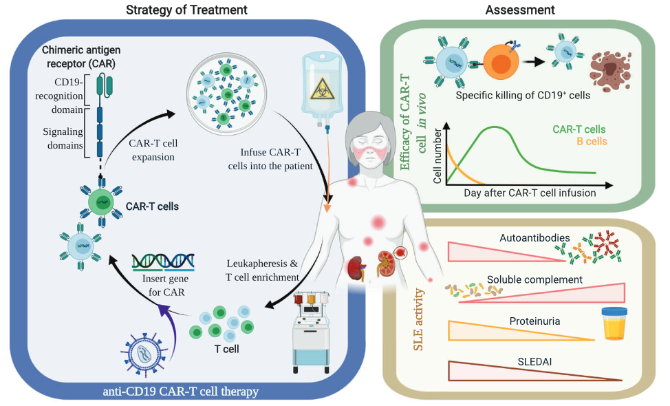 动物模型实验|一文梳理系统性红斑狼疮(SLE)创新药物研发之路 - 知乎