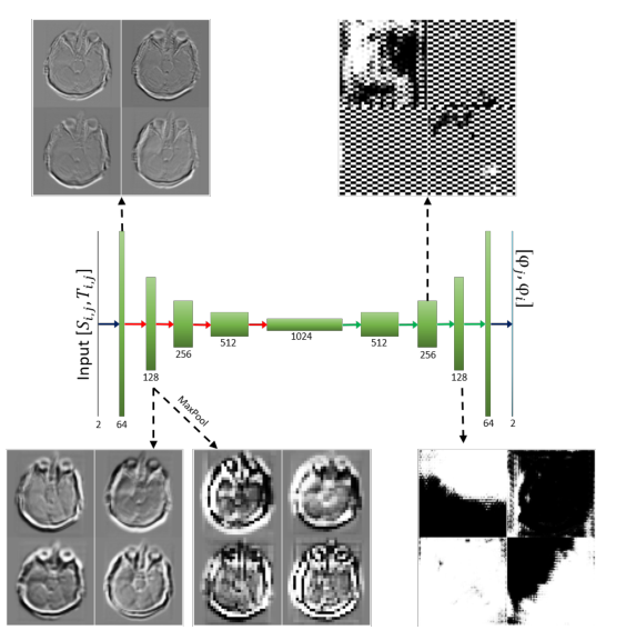 Deformable image registration using convolutional neural network笔记 - 知乎