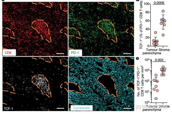 经典案例合集|头颈癌肿瘤微环境研究不可错过这八篇！ - 知乎