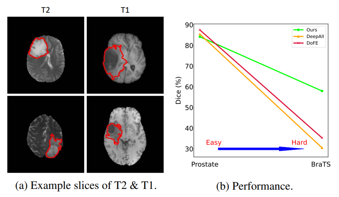论文笔记21：Generalizable Cross-modality Medical Image Segmentation via Style Augmentation and Dual ...