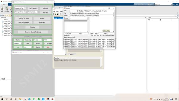 如何用SPM完成fMRI数据的预处理【任务态】 - 知乎